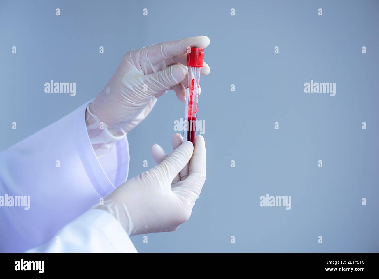 Doctor hand with latex glove holding Blood test tube on Sterile room ...