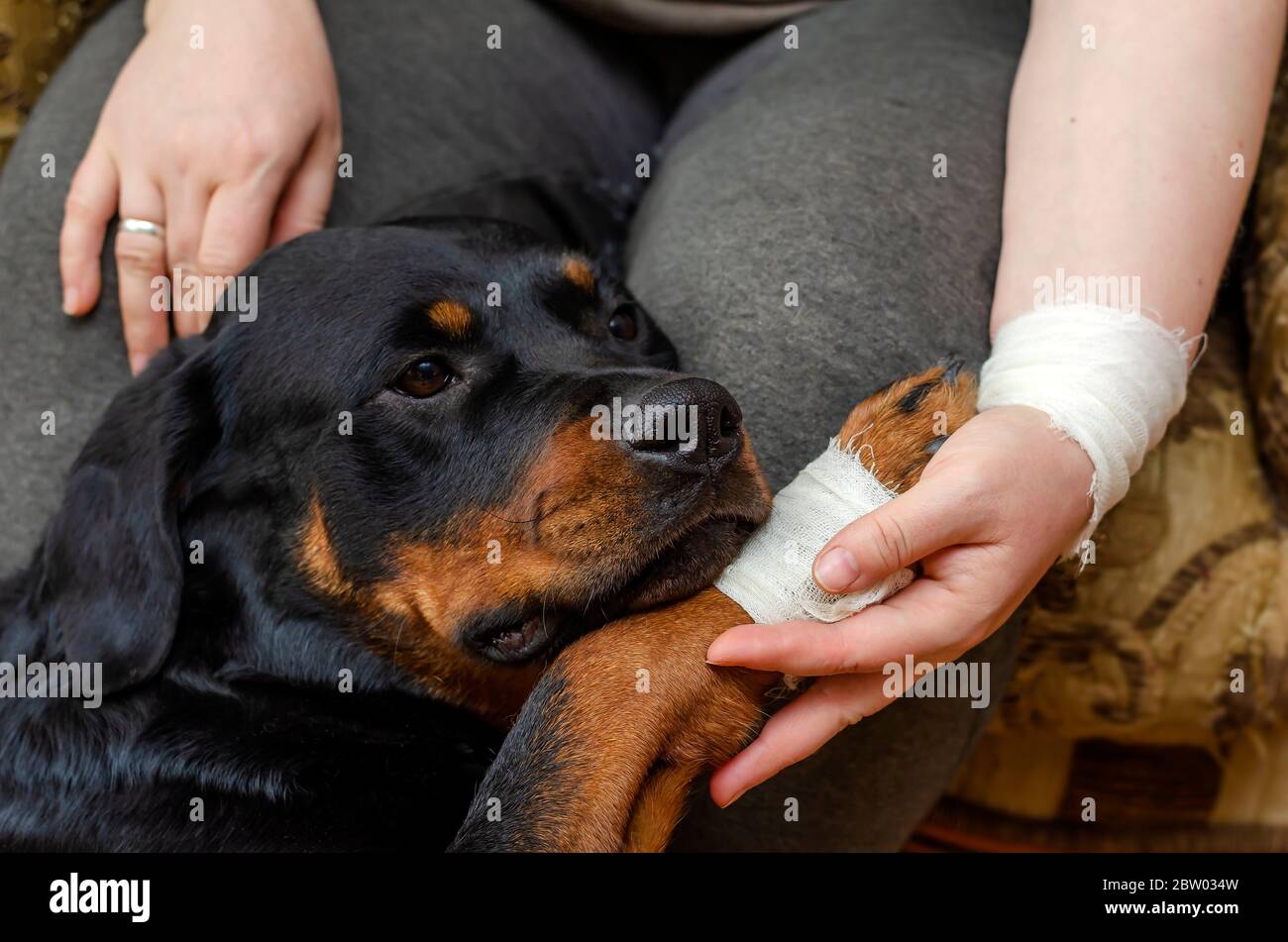 Rottweiler Bite Injury