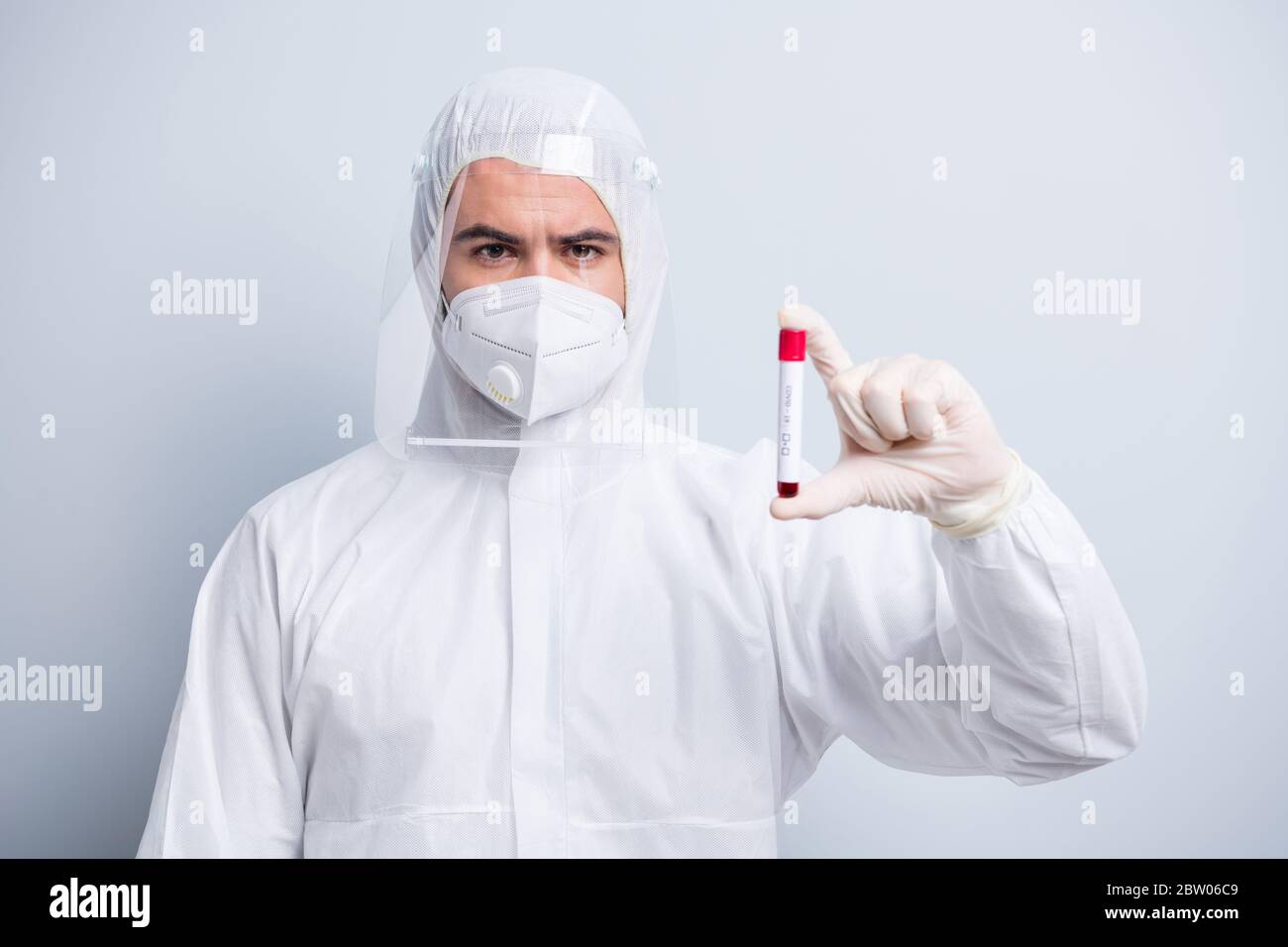 Photo of serious guy expert virology center clinic hold patient blood ...