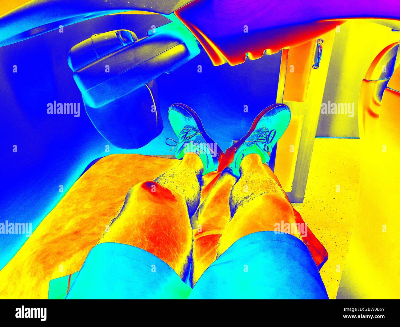 Thermal image of Physical therapy using a laser to treat an injured ...
