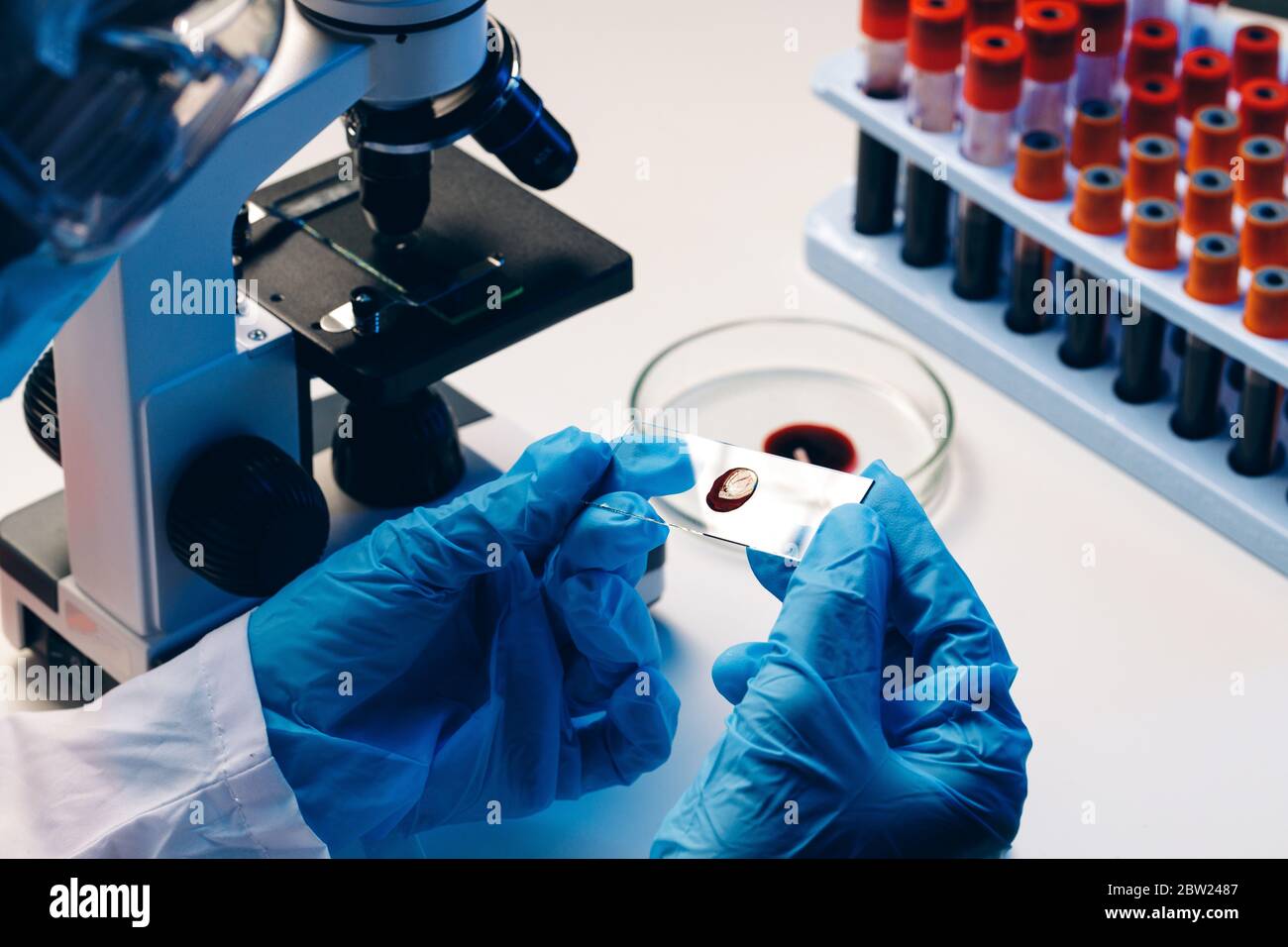 Hands of a laboratory worker doing blood test Stock Photo - Alamy