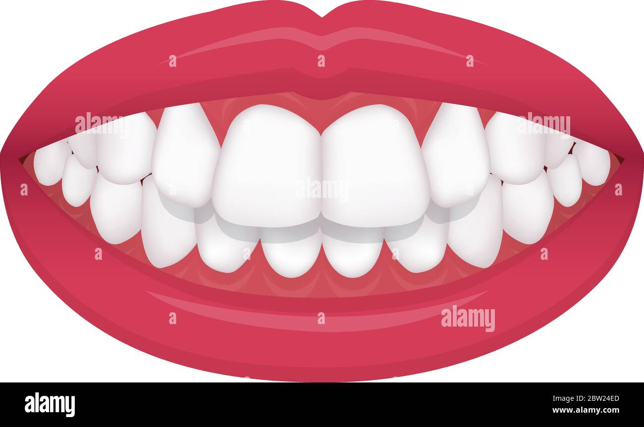 Teeth trouble ( bite type / crooked teeth ) vector illustration ...