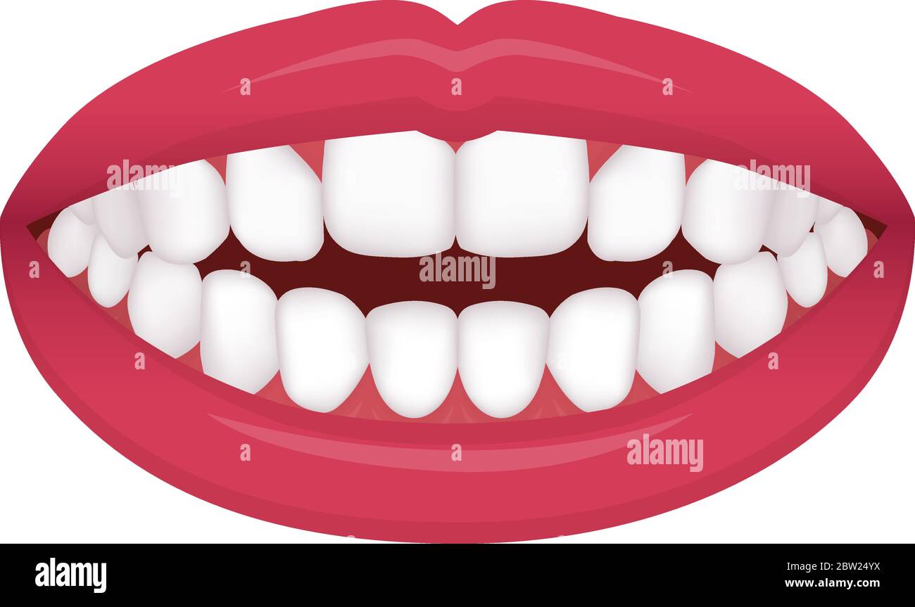 Teeth trouble ( bite type / crooked teeth ) vector illustration /Open ...