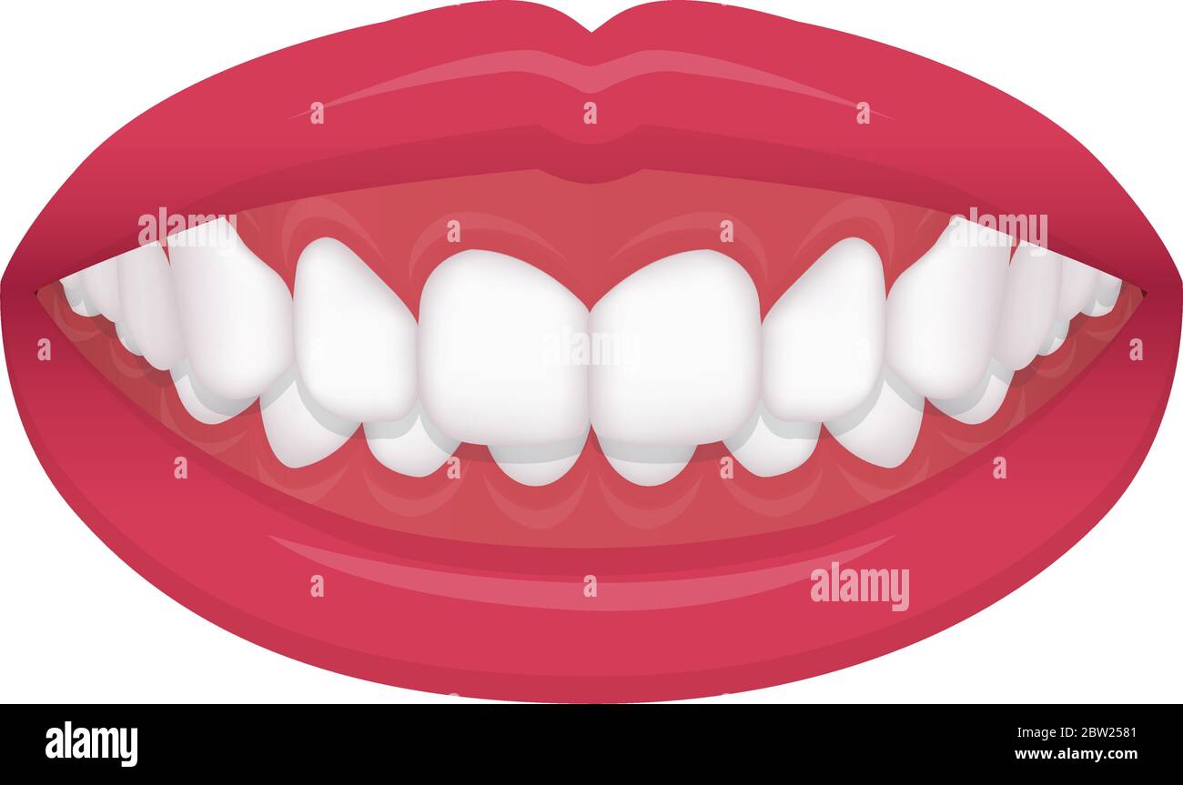 Teeth trouble ( bite type / crooked teeth ) vector illustration /Deep ...