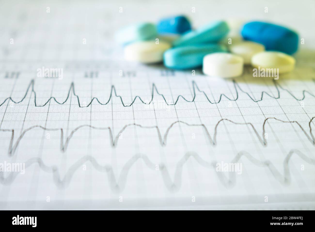 White, blue and light blue pills on an electrocardiogram paper ...