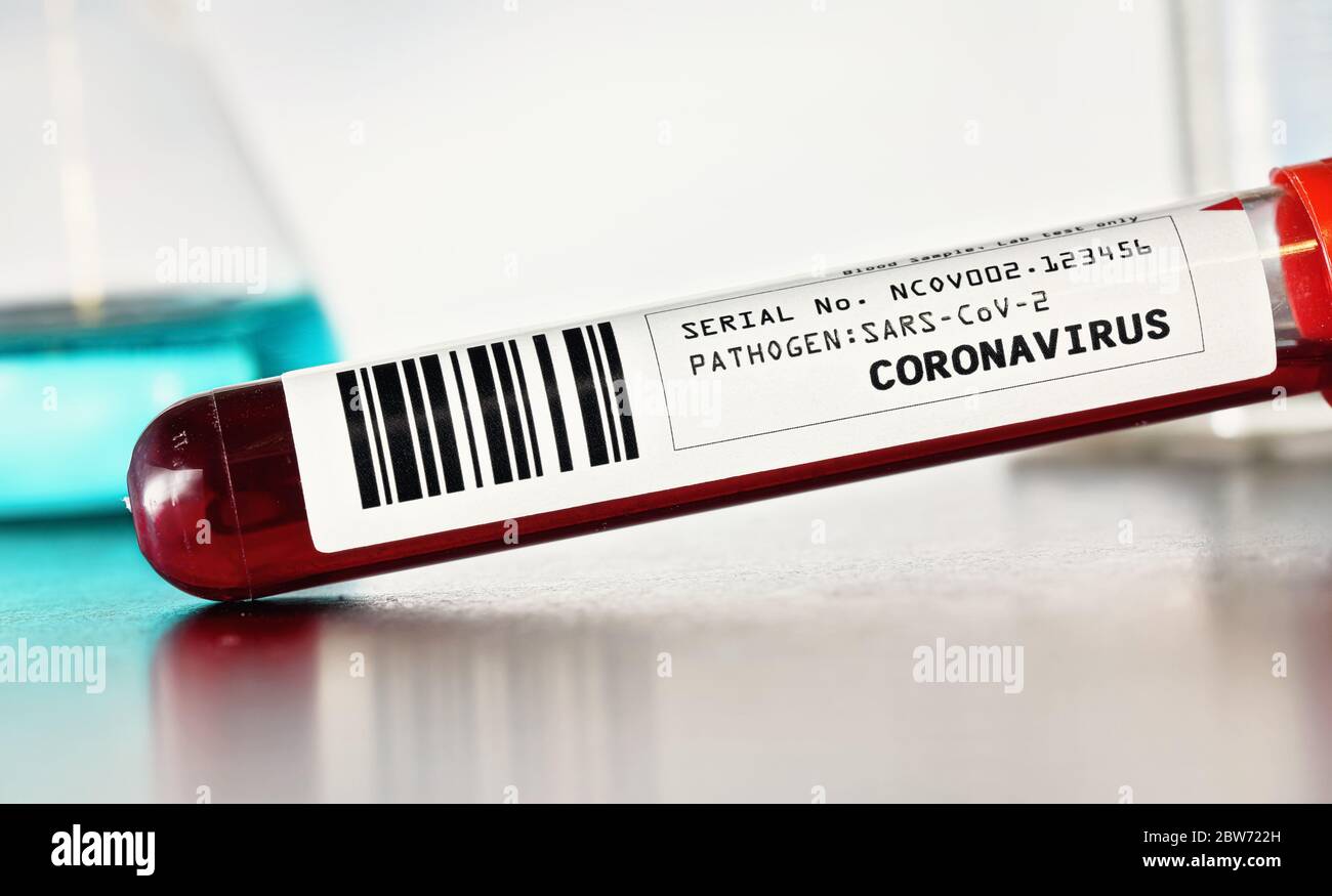 Blood vial barcode hi-res stock photography and images - Alamy