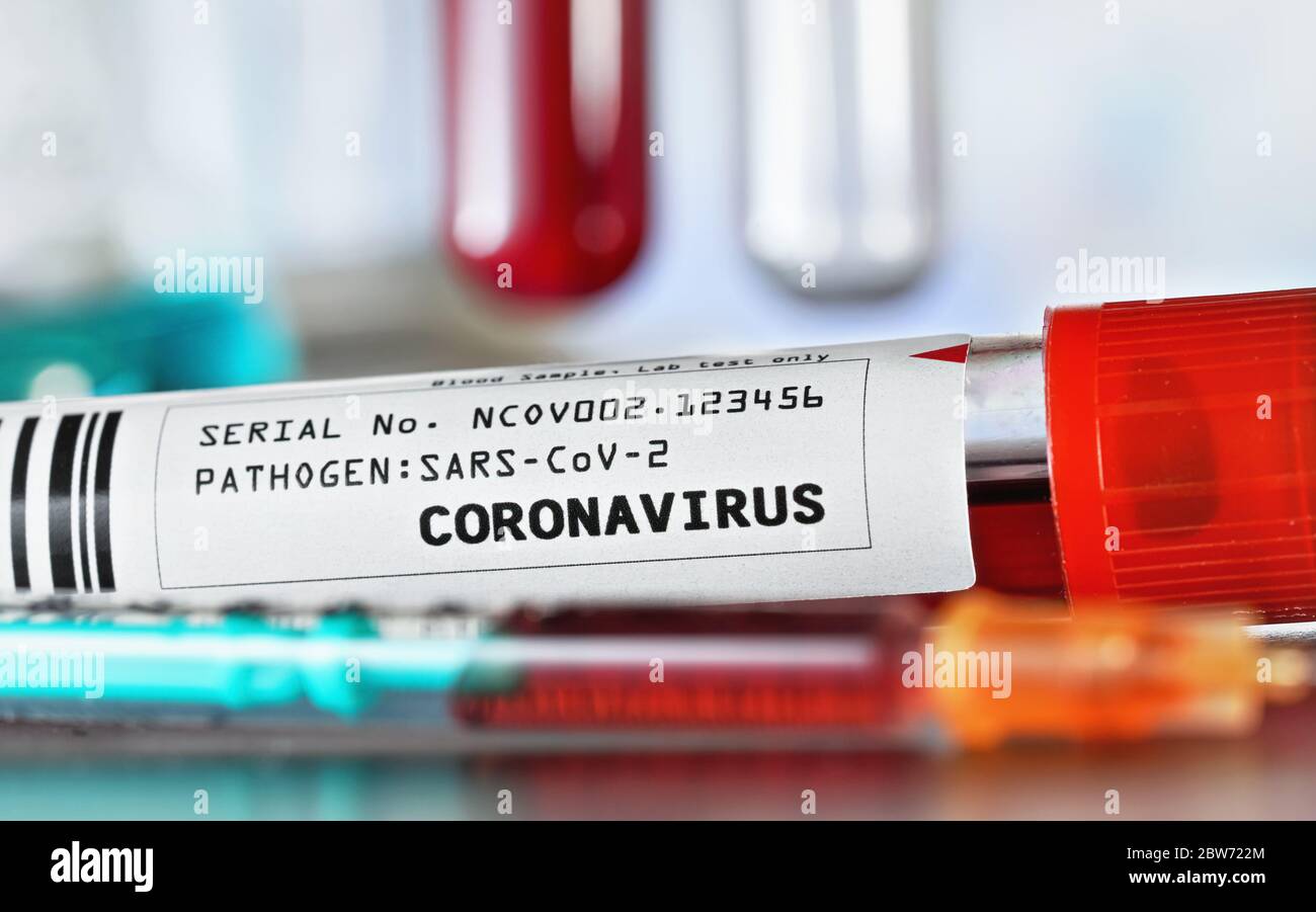 Sample vial with blood, label says coronavirus test (sticker is own ...