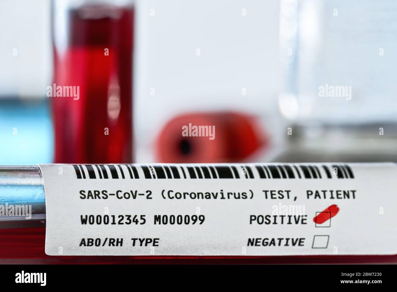 Checkmark tube hi-res stock photography and images - Alamy