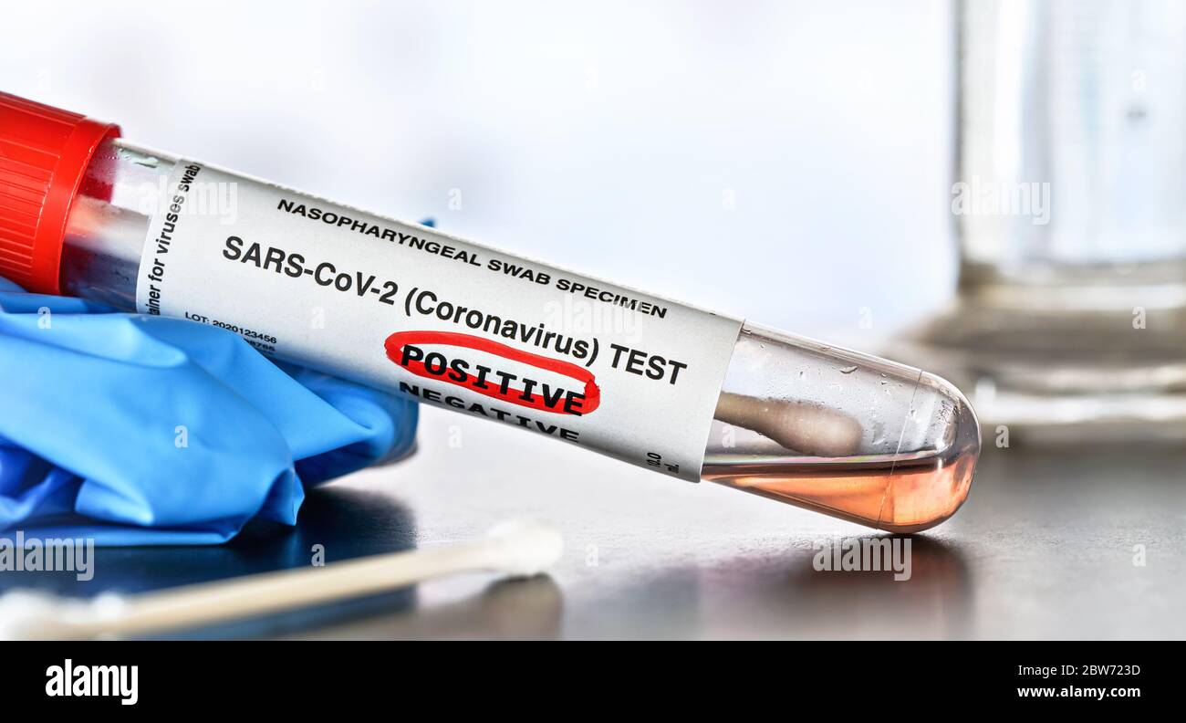 Coronavirus test concept - vial sample tube with cotton swab, red mark ...
