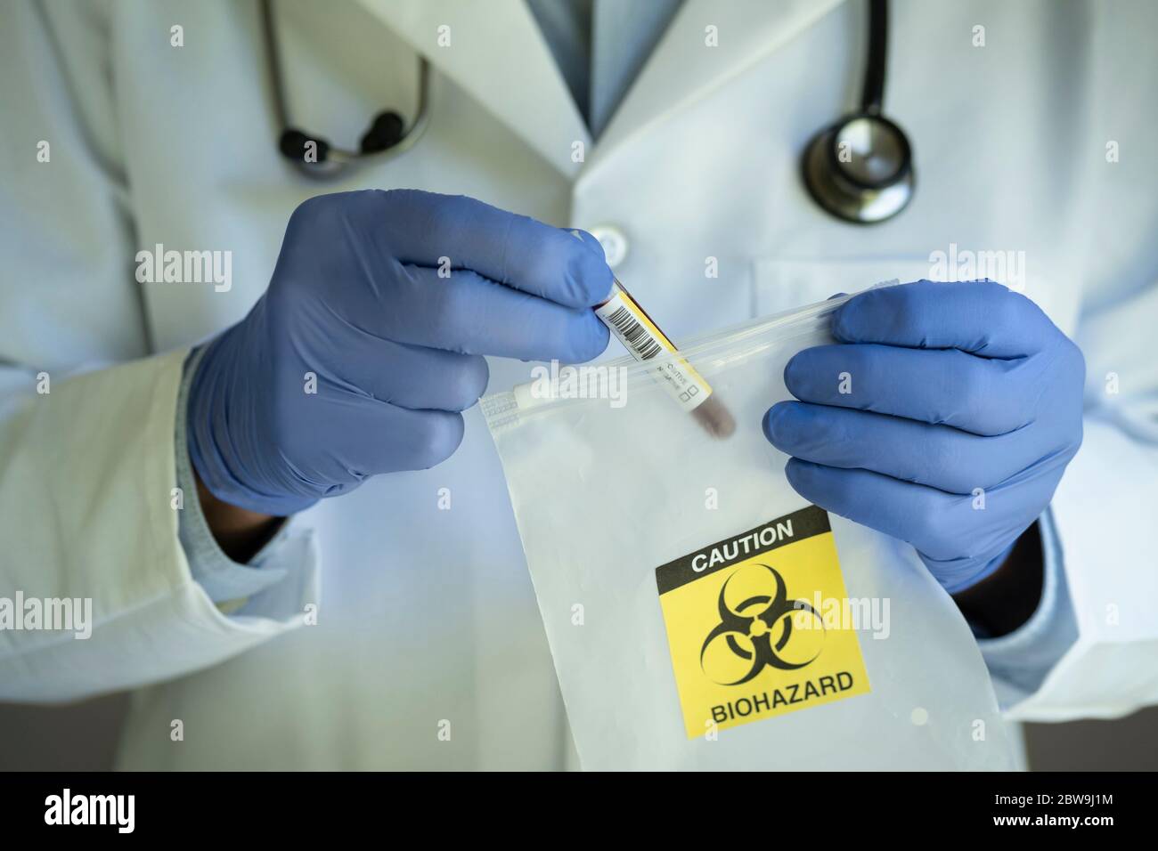 Close-up of doctors hands holding test tube with blood and bag with ...