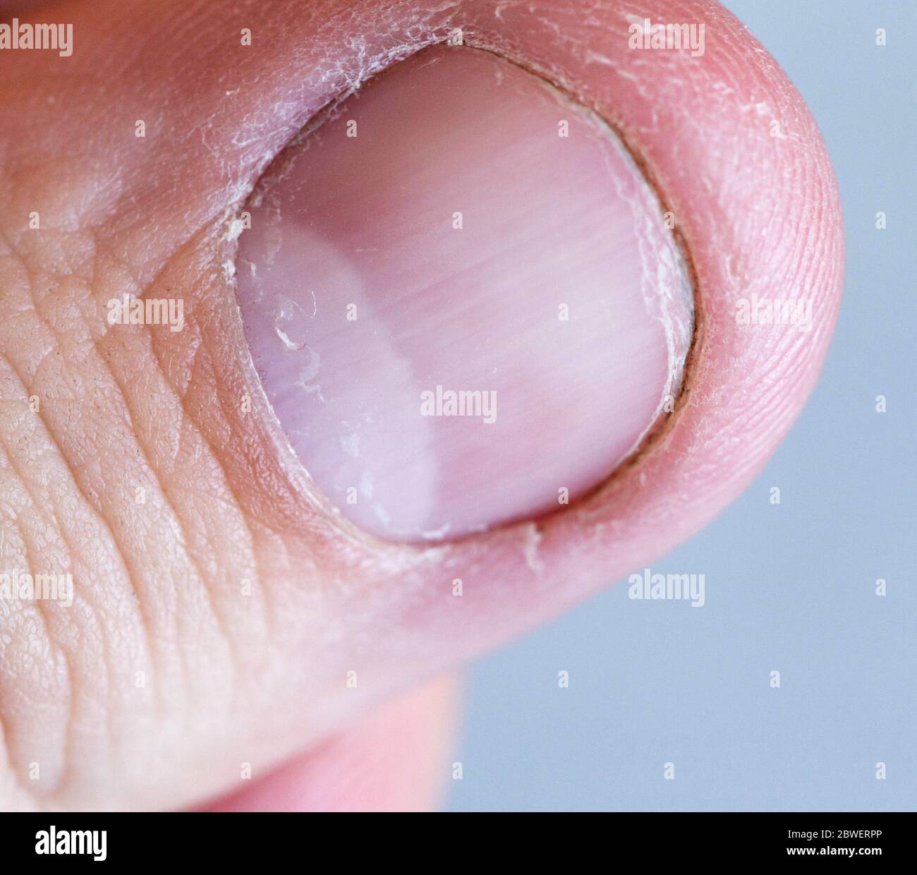 Groomed fingernail with cuticle and burrs, macro Stock Photo - Alamy