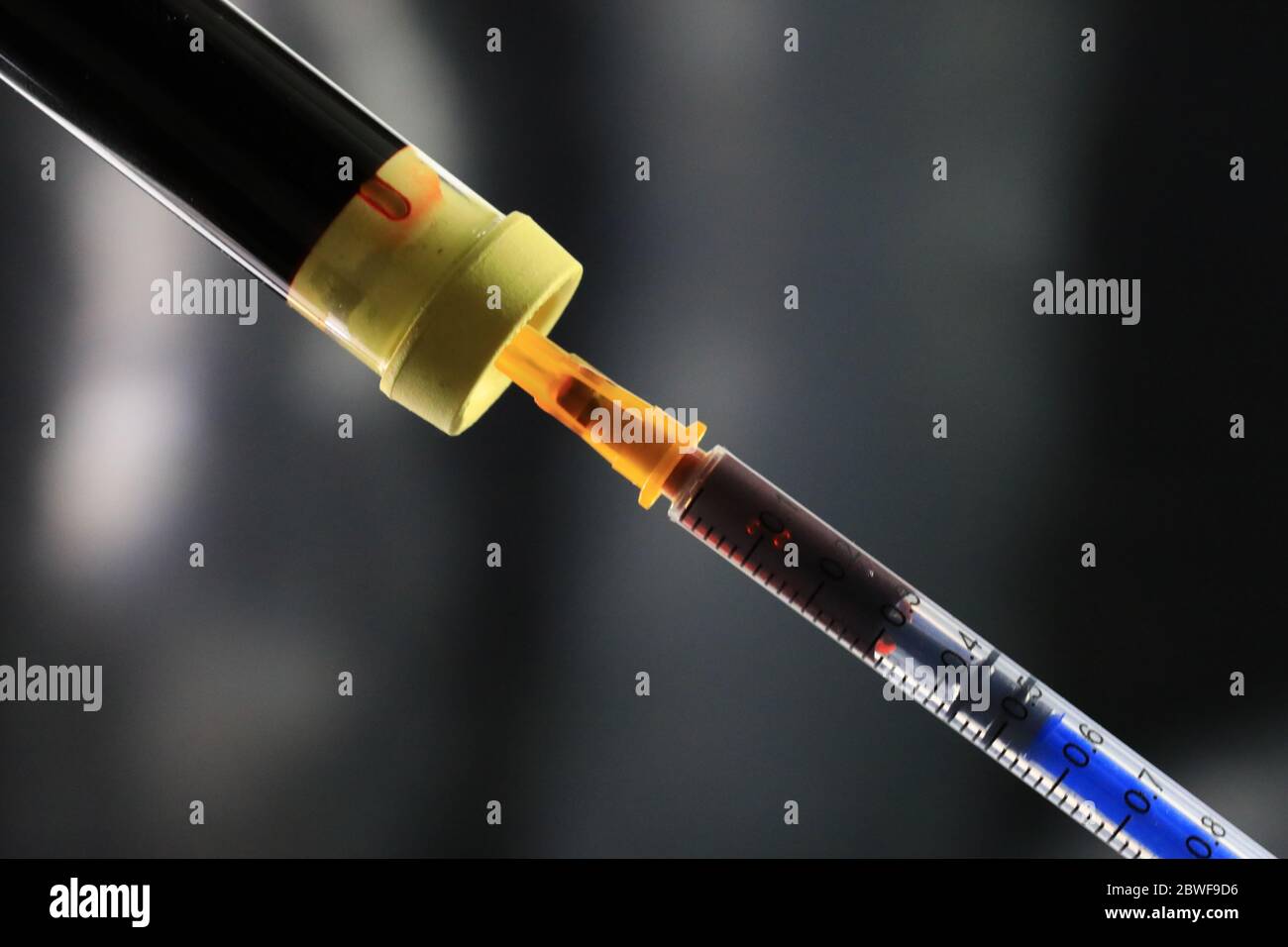 Blood draw equipment for cholesterol testing Stock Photo - Alamy