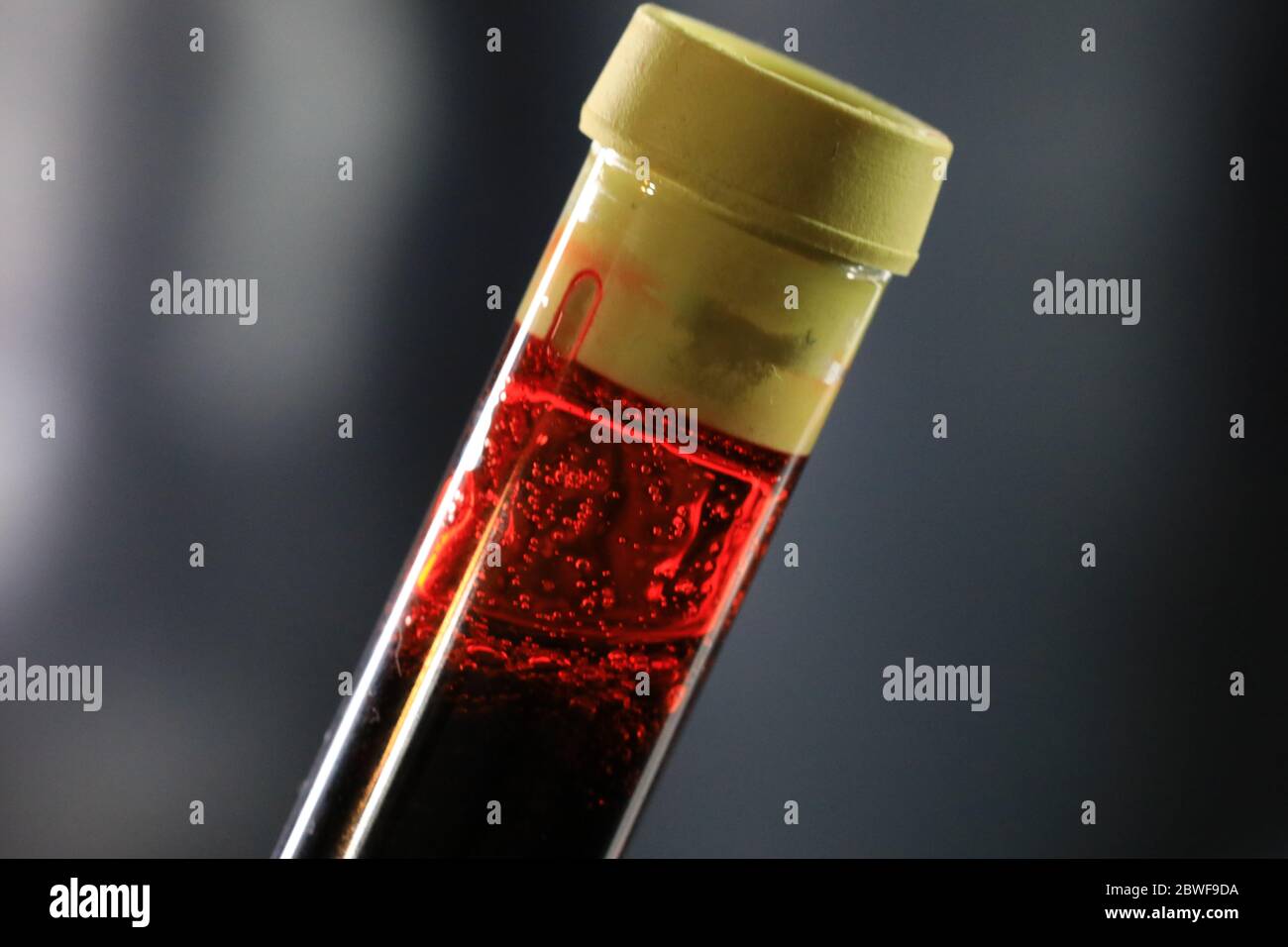Blood vial hi-res stock photography and images - Alamy