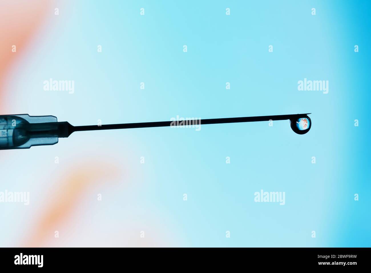 Human Embryo High Resolution Stock Photography and Images - Alamy