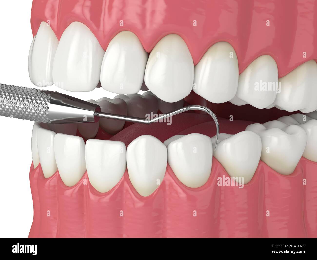 3d render of jaw with dental explorer. Dental diagnostic tools concept ... 3d render of jaw with dental explorer. Dental diagnostic tools concept ...