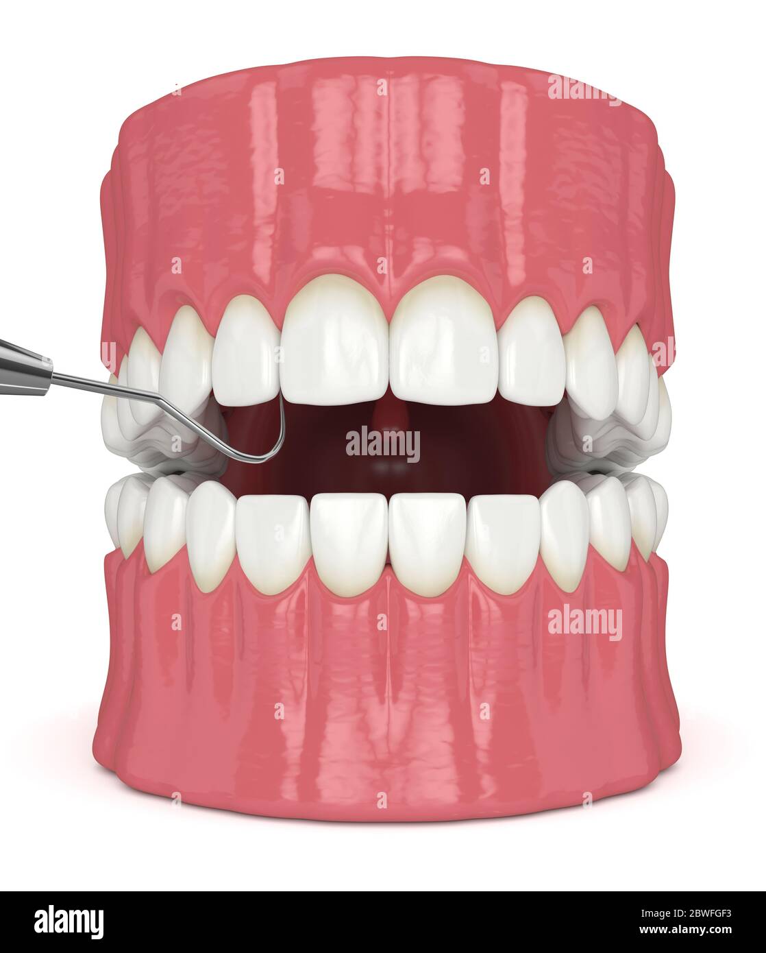 3d render of jaw with dental explorer over white background. Dental ...