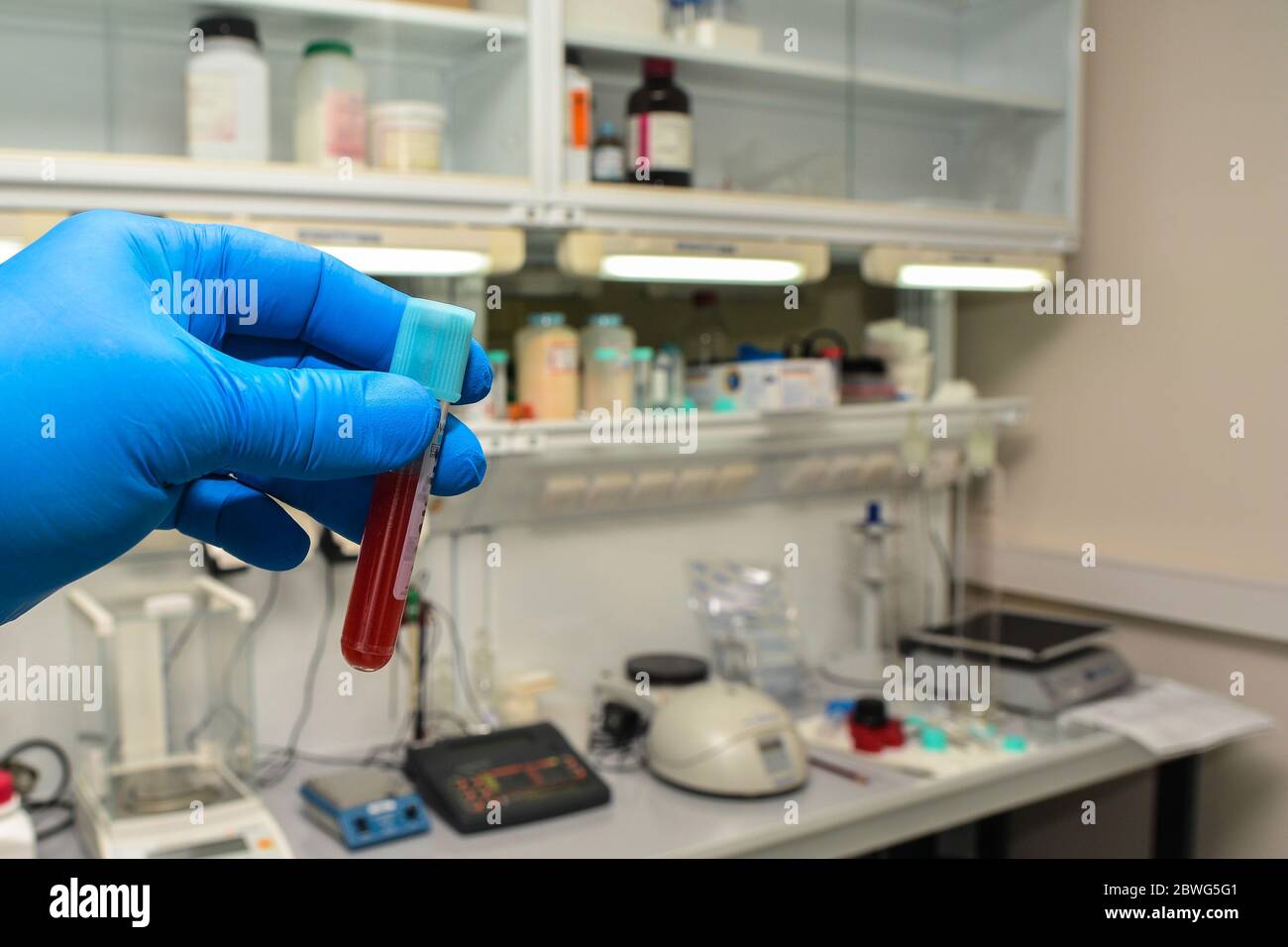 Laboratory testing of a biological sample. A gloved hand holds a test ...