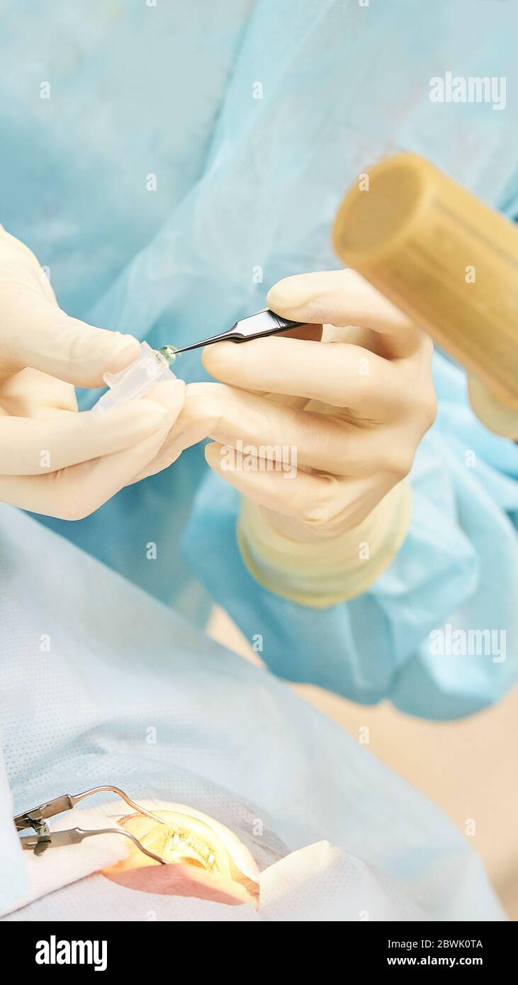 Ophthalmology laser microscope operation. Doctor in clinic. Patient eye ...