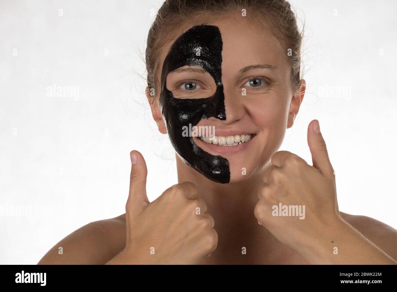 Happy beautiful girl with acne smiling on a white background in a ...