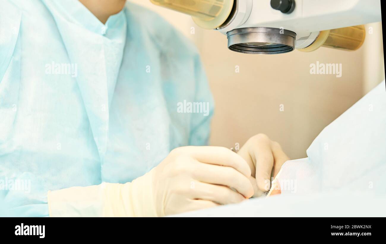 Ophthalmology laser microscope operation. Doctor in clinic. Patient eye ...