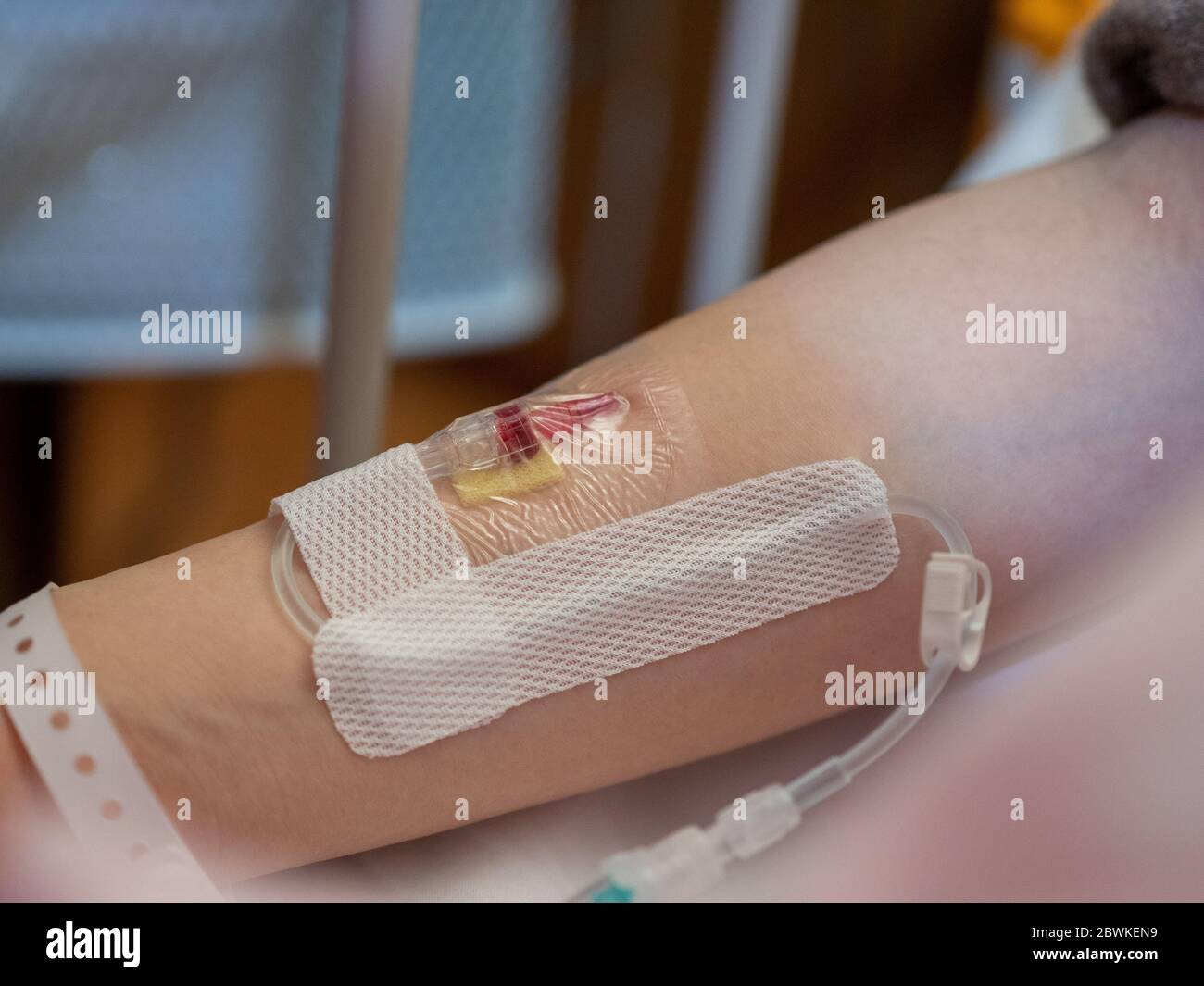Iv infection hi-res stock photography and images - Alamy