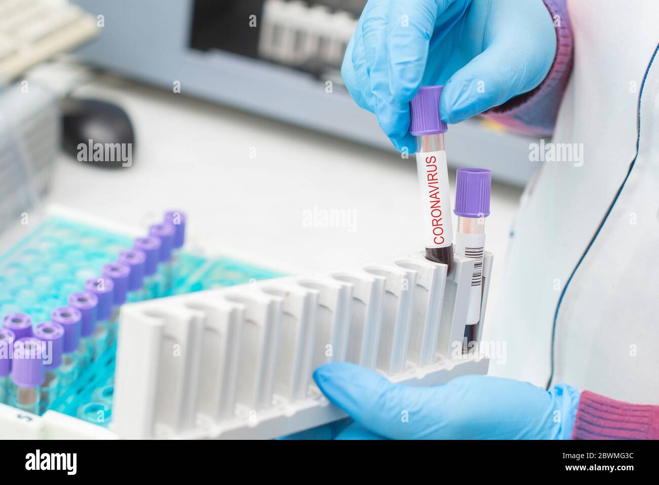 doctor hand taking a blood sample tube from a rack with machines of ...