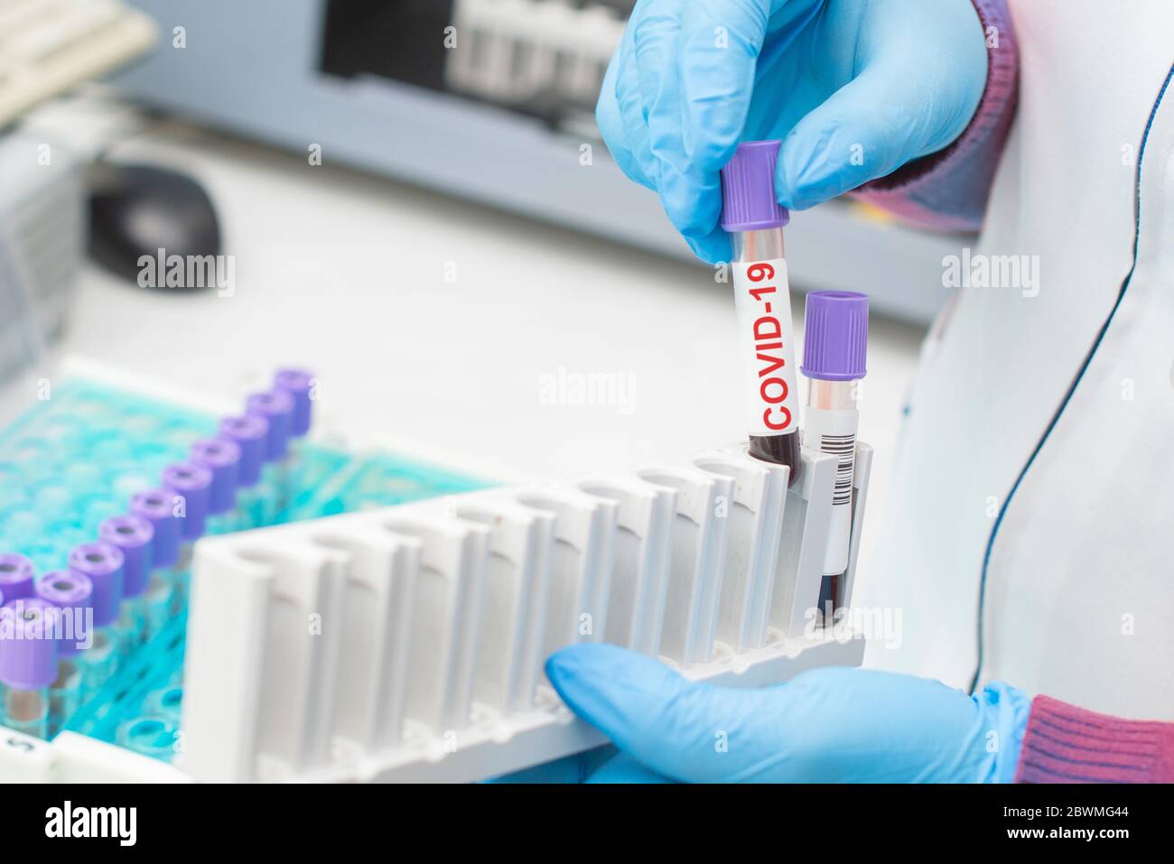 doctor hand taking a blood sample tube from a rack with machines of ...