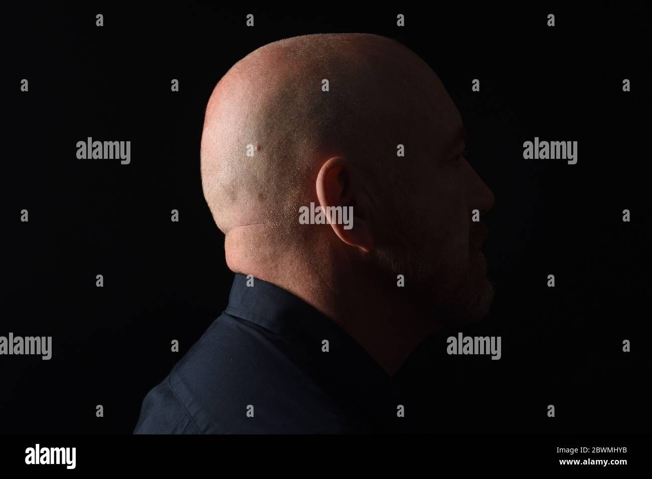 Bald head behind hi-res stock photography and images - Alamy