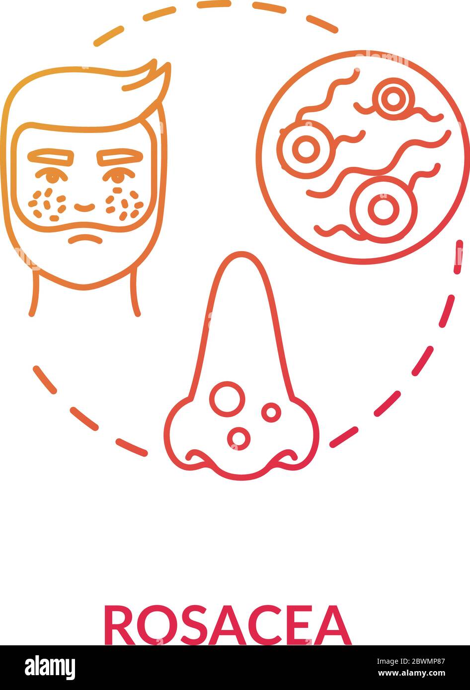 Rosacea concept icon Stock Vector Image & Art - Alamy