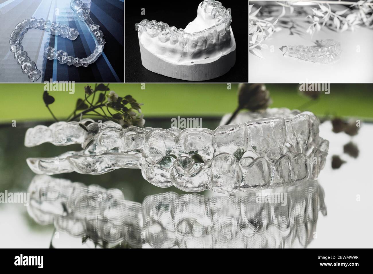 collage of teeth brackets or aligners to straighten teeth, transparent ...
