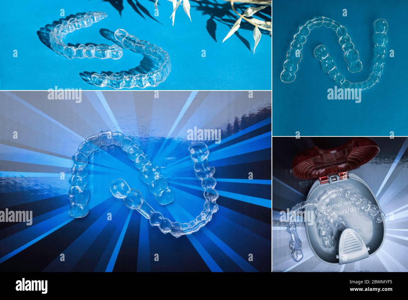 collage of teeth brackets or aligners to straighten teeth, transparent ...