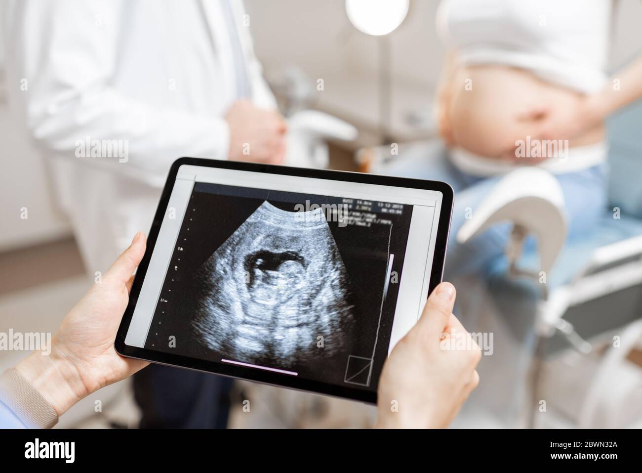 Medics with an ultrasound scan of unborn child on a digital tablet ...