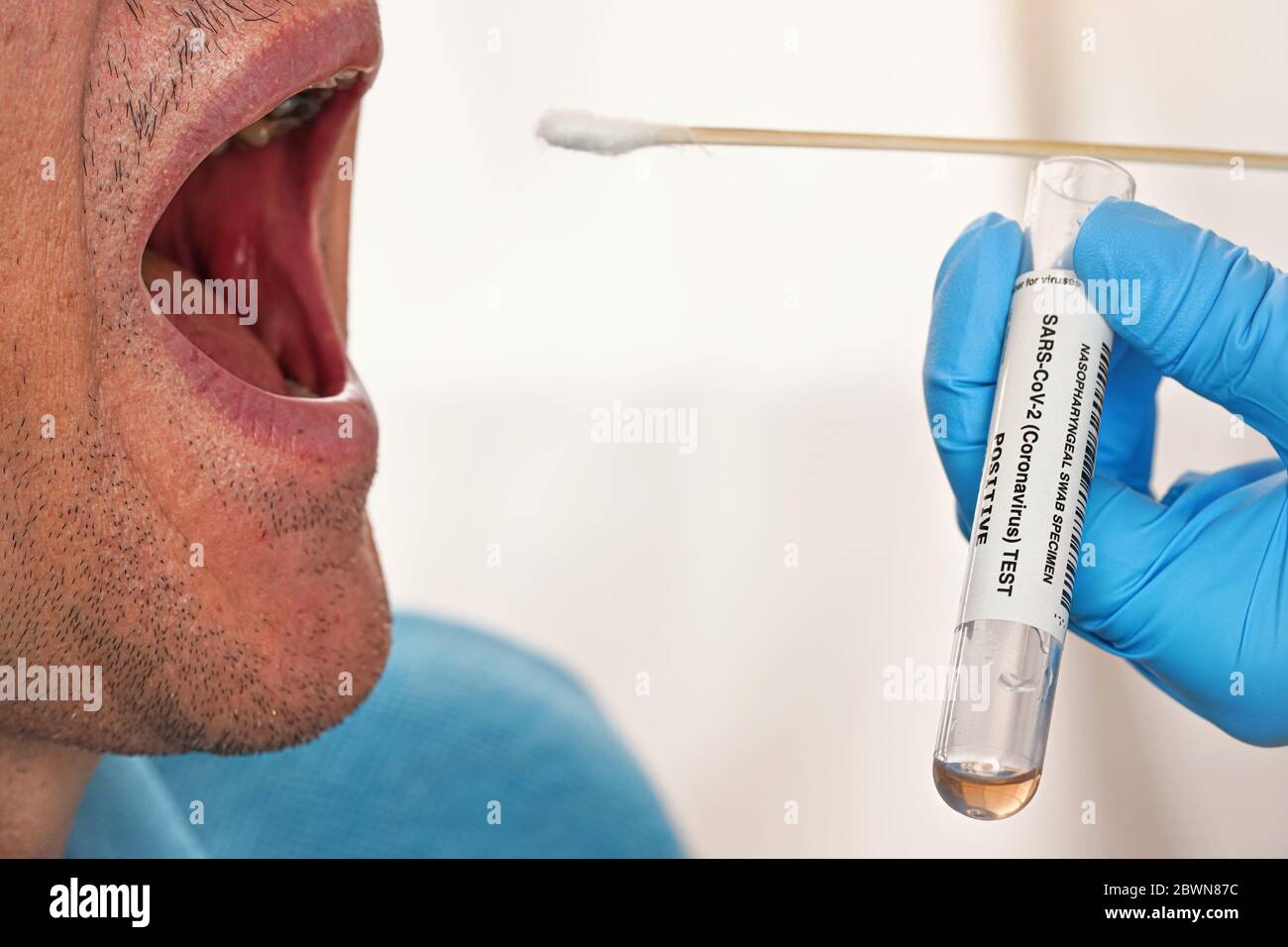 Hand swab hi-res stock photography and images - Alamy