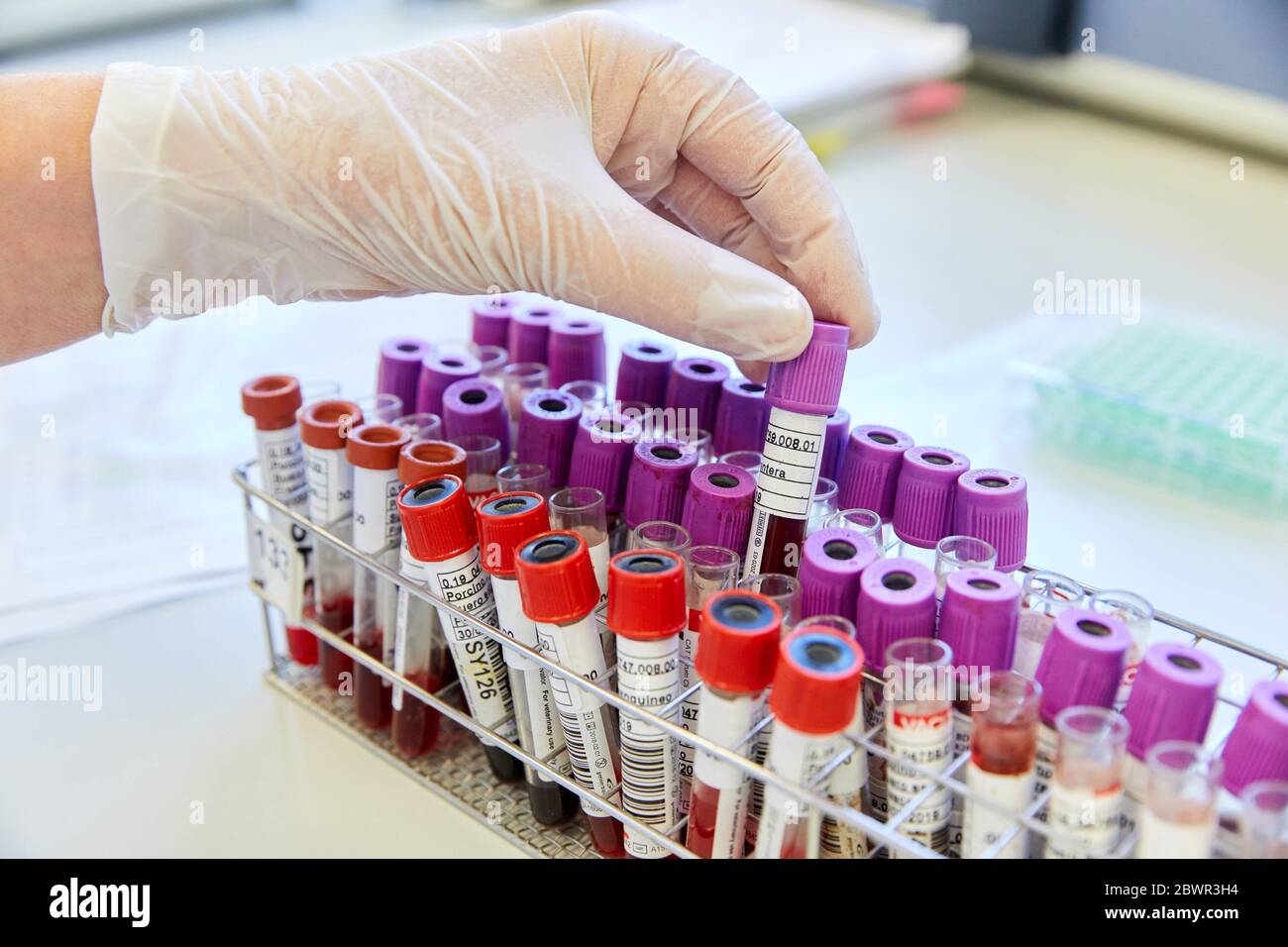 Blood test laboratory hi-res stock photography and images - Alamy