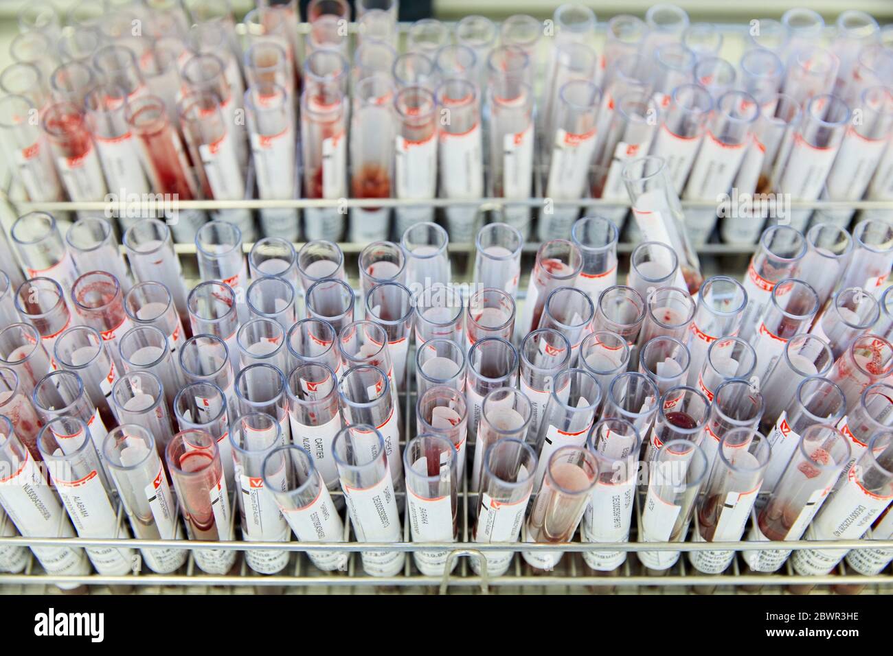 Blood sample tubes hi-res stock photography and images - Alamy