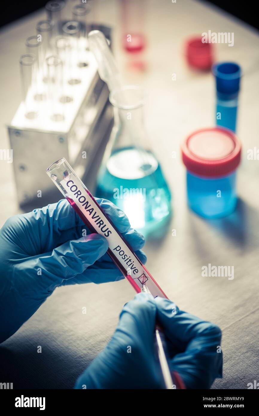 Conceptual photograph of a doctor's hands holding and marking a test ...