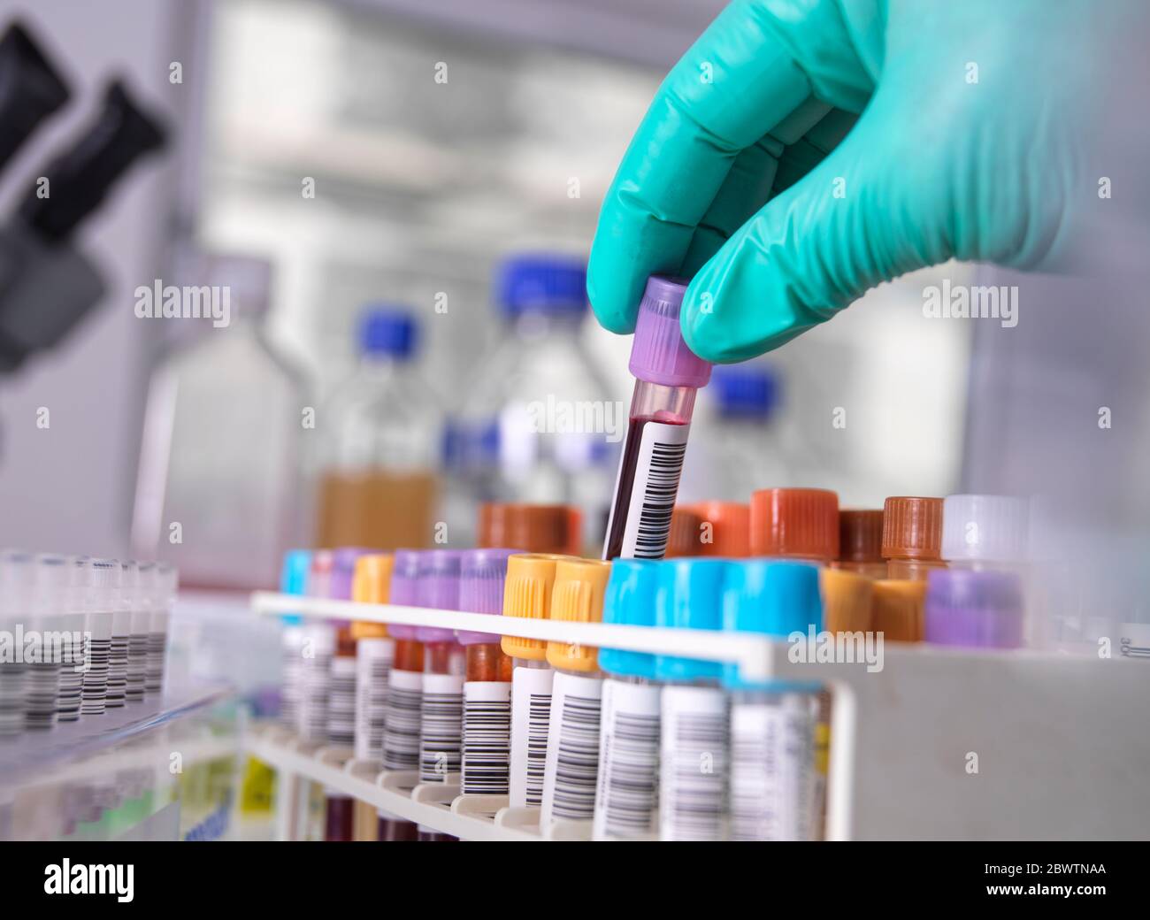 Hand glove laboratory sample hi-res stock photography and images - Alamy