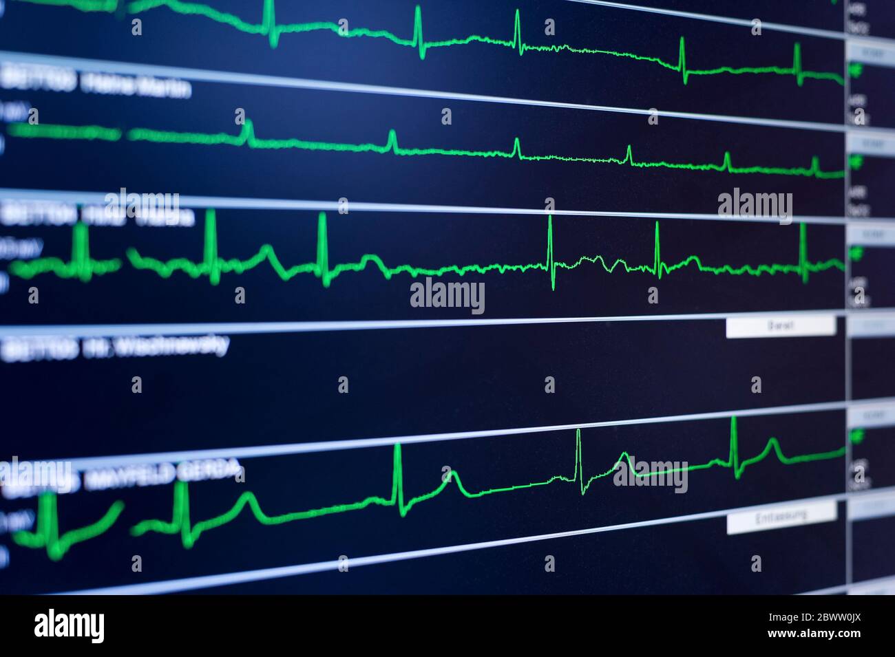 Ekg chart hi-res stock photography and images - Alamy