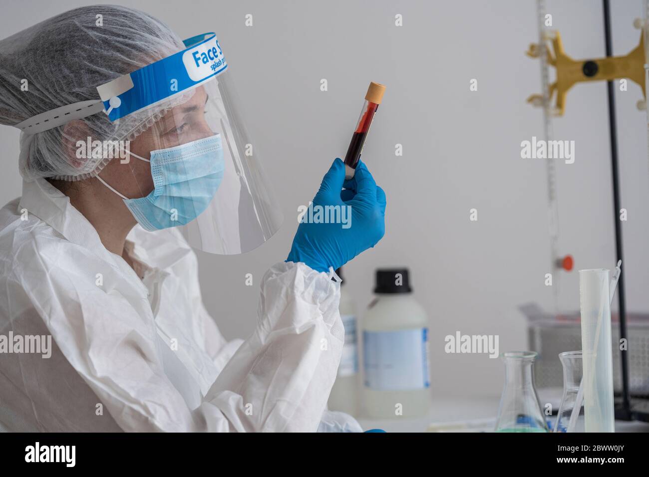 Doctor examining corona blood hi-res stock photography and images - Alamy