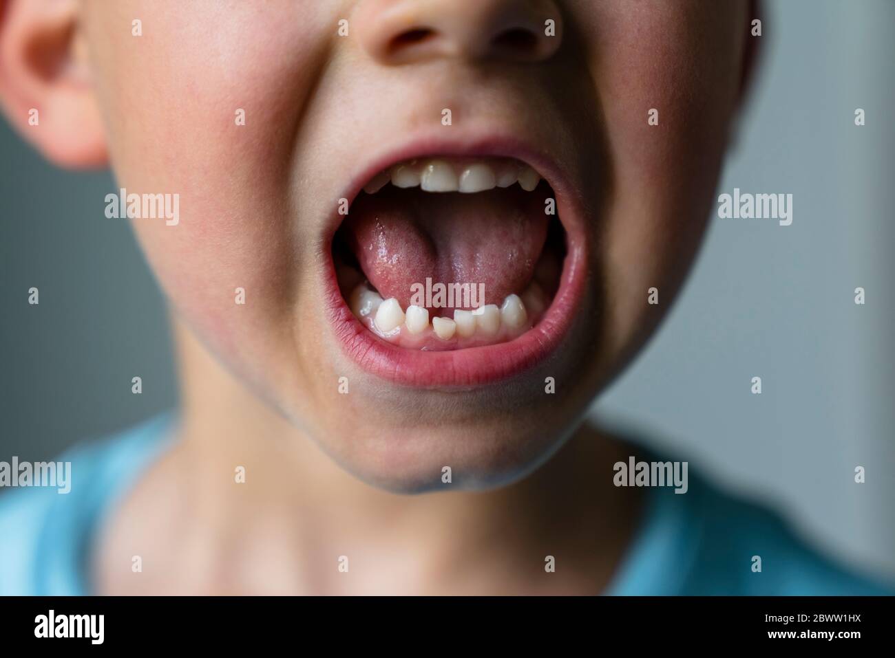 Crop view of little boy showing his milk teeth Stock Photo - Alamy