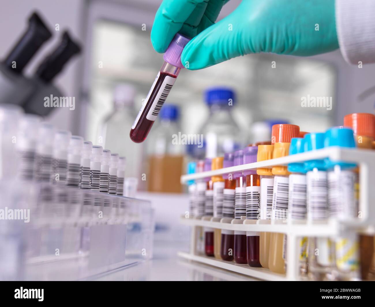 Hand glove laboratory sample hi-res stock photography and images - Alamy