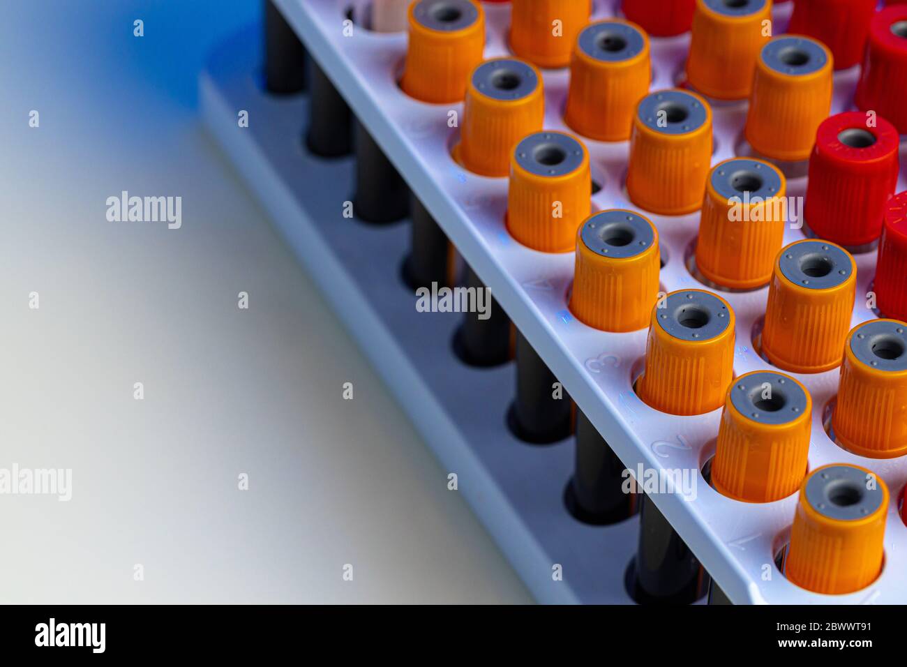 Blood test tubes in lab close up Stock Photo - Alamy