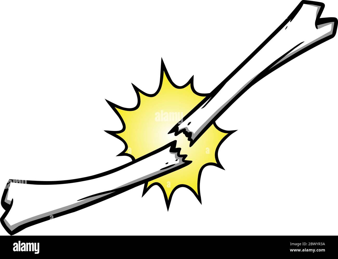 Break bone Stock Vector Images - Alamy