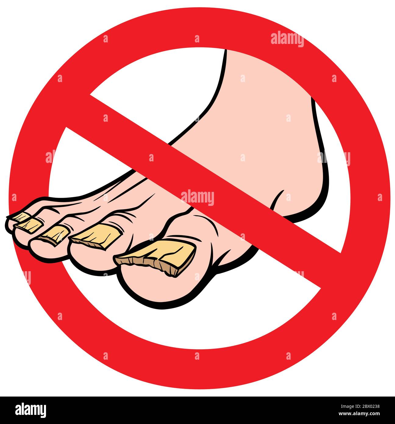 No Nail Fungus- An Illustration of a No Nail Fungus Sign Stock Vector ...