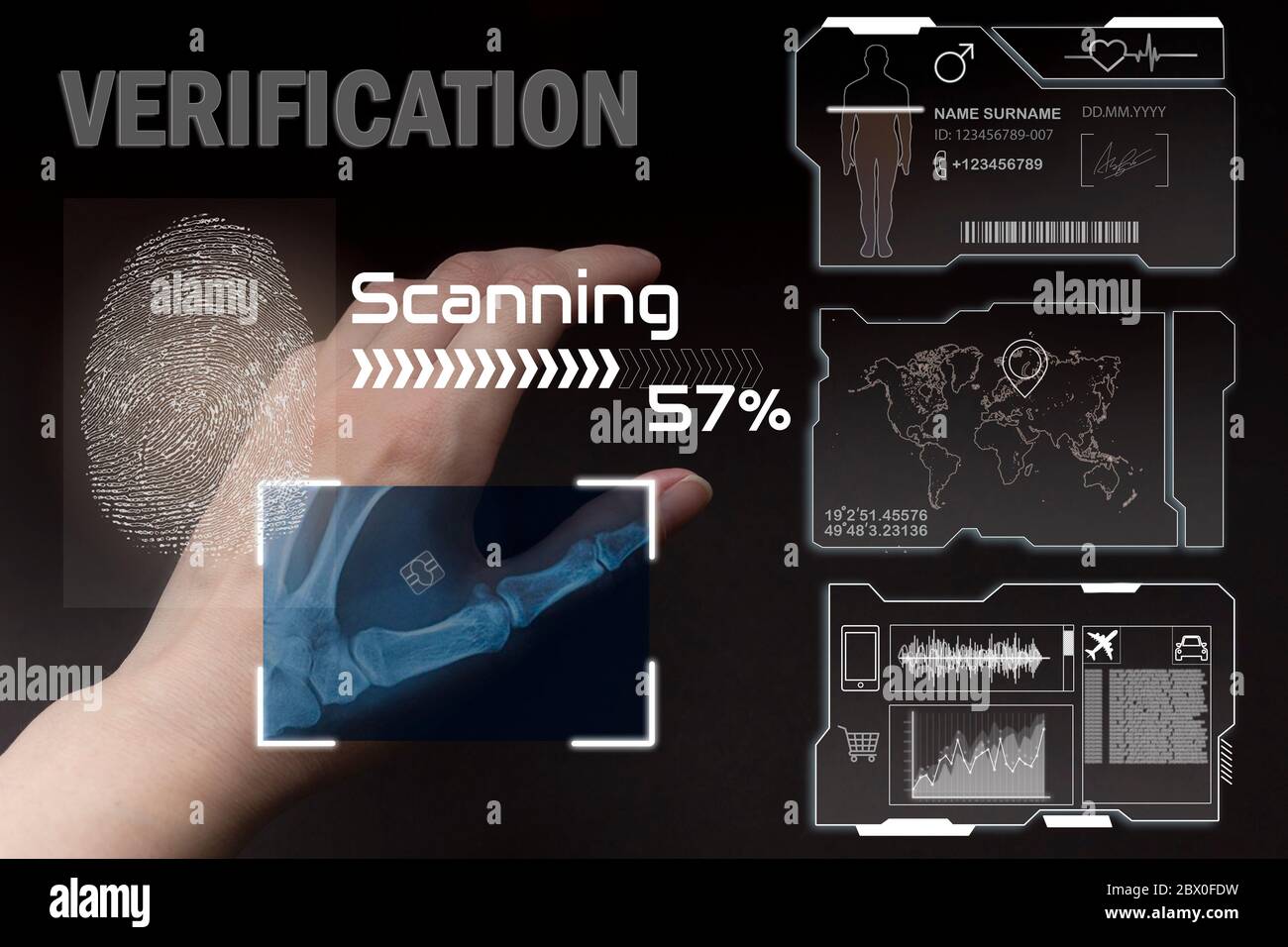 Microchip implant x ray hand hi-res stock photography and images - Alamy