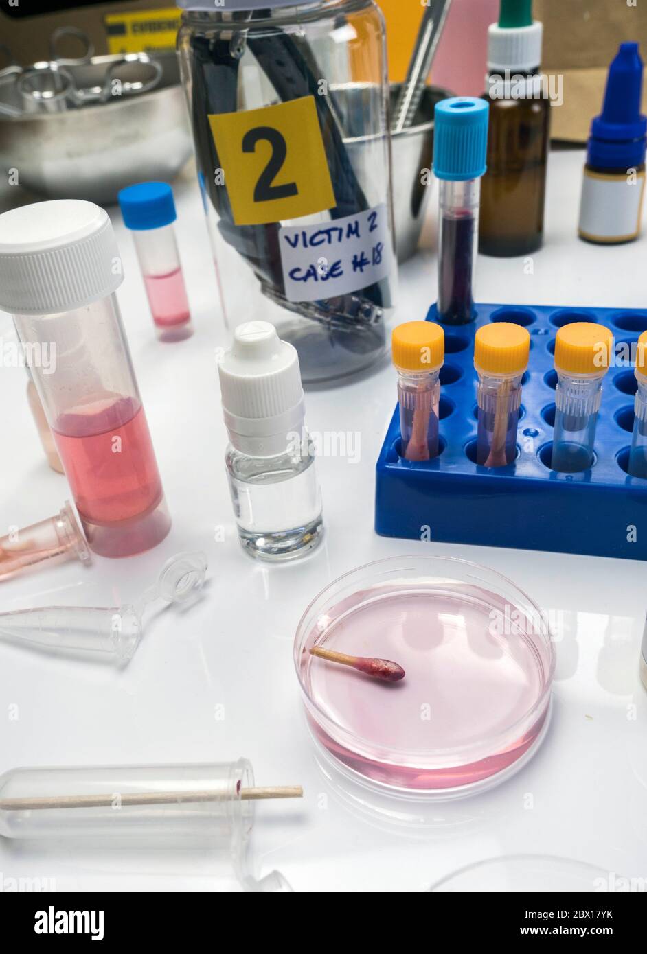 Hematological analysis with forensic test kit in a murder in a crime ...