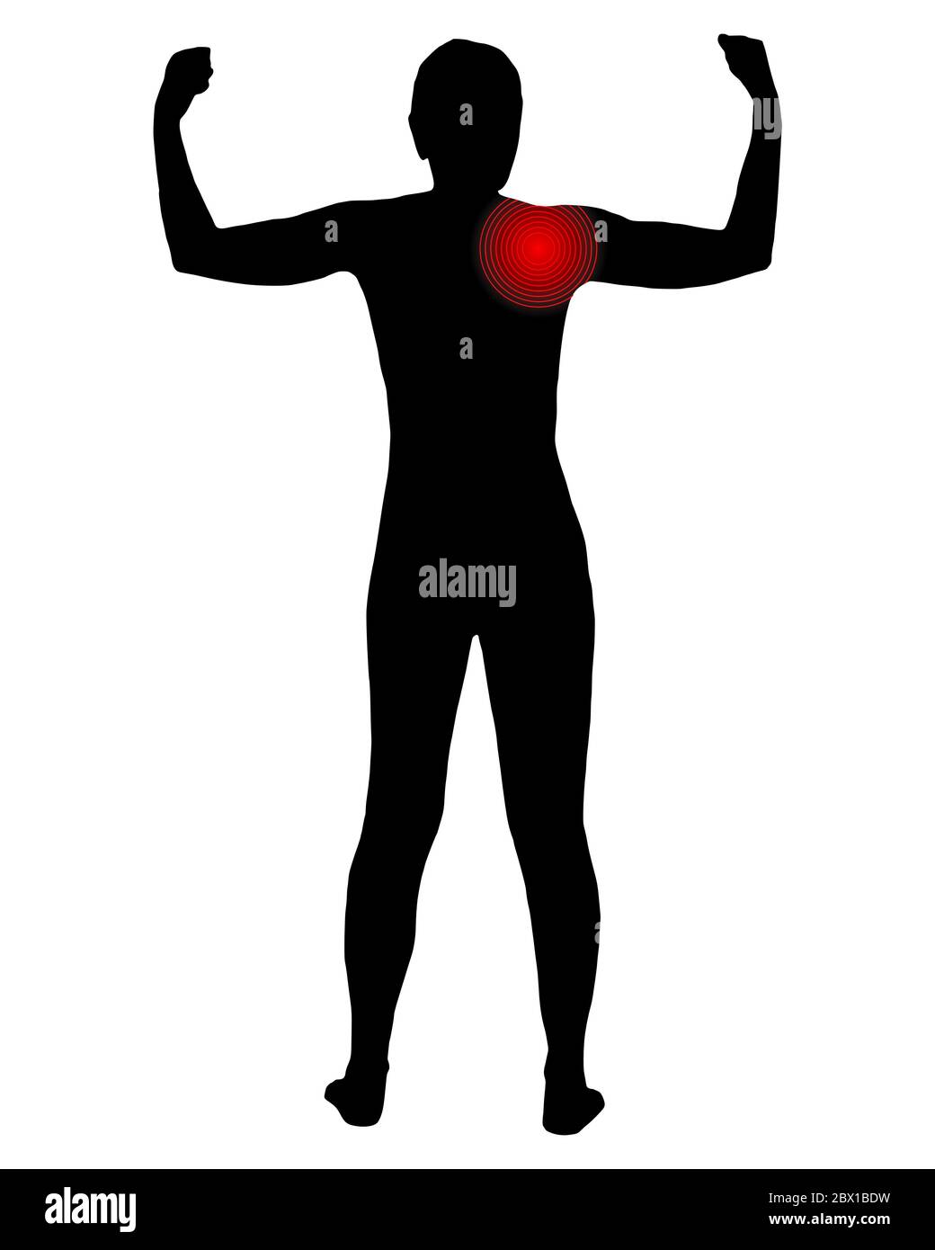 Back view of woman with with symbol for shoulder pain Stock Photo - Alamy