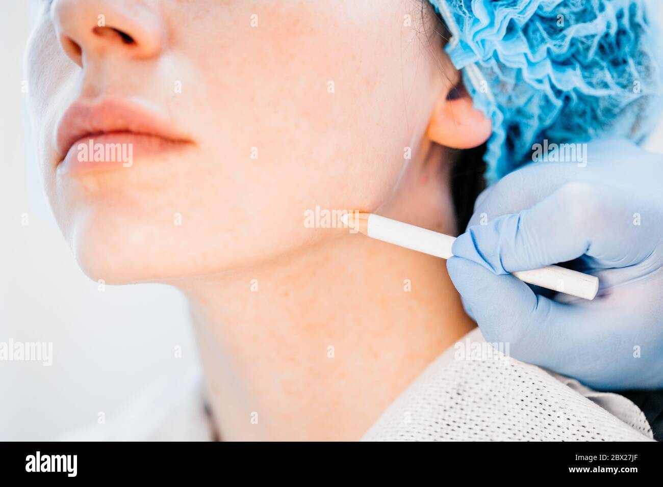 Contour correction is a procedure for filling wrinkles and restoring ...