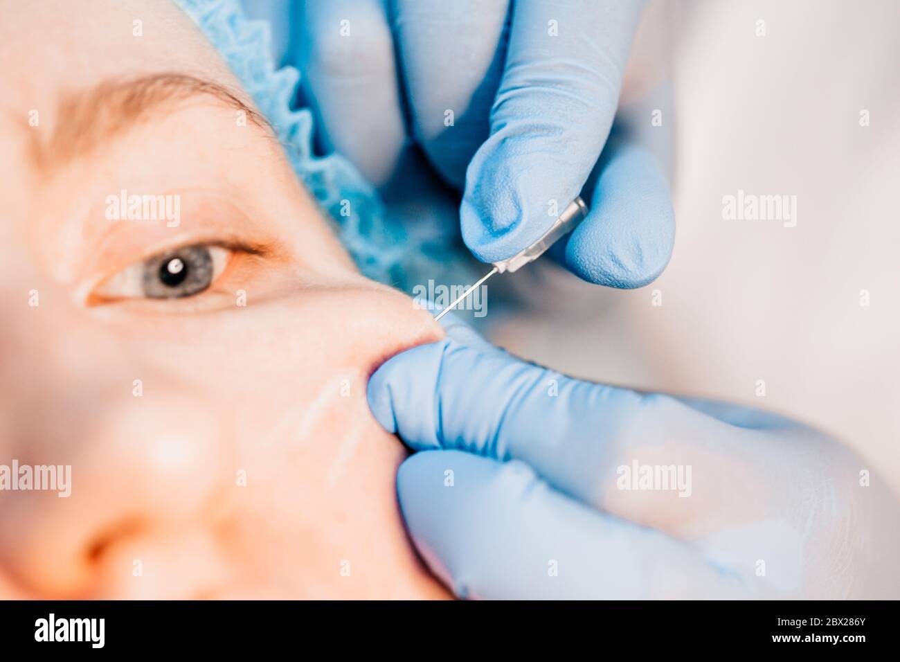 Plastic correction hi-res stock photography and images - Alamy