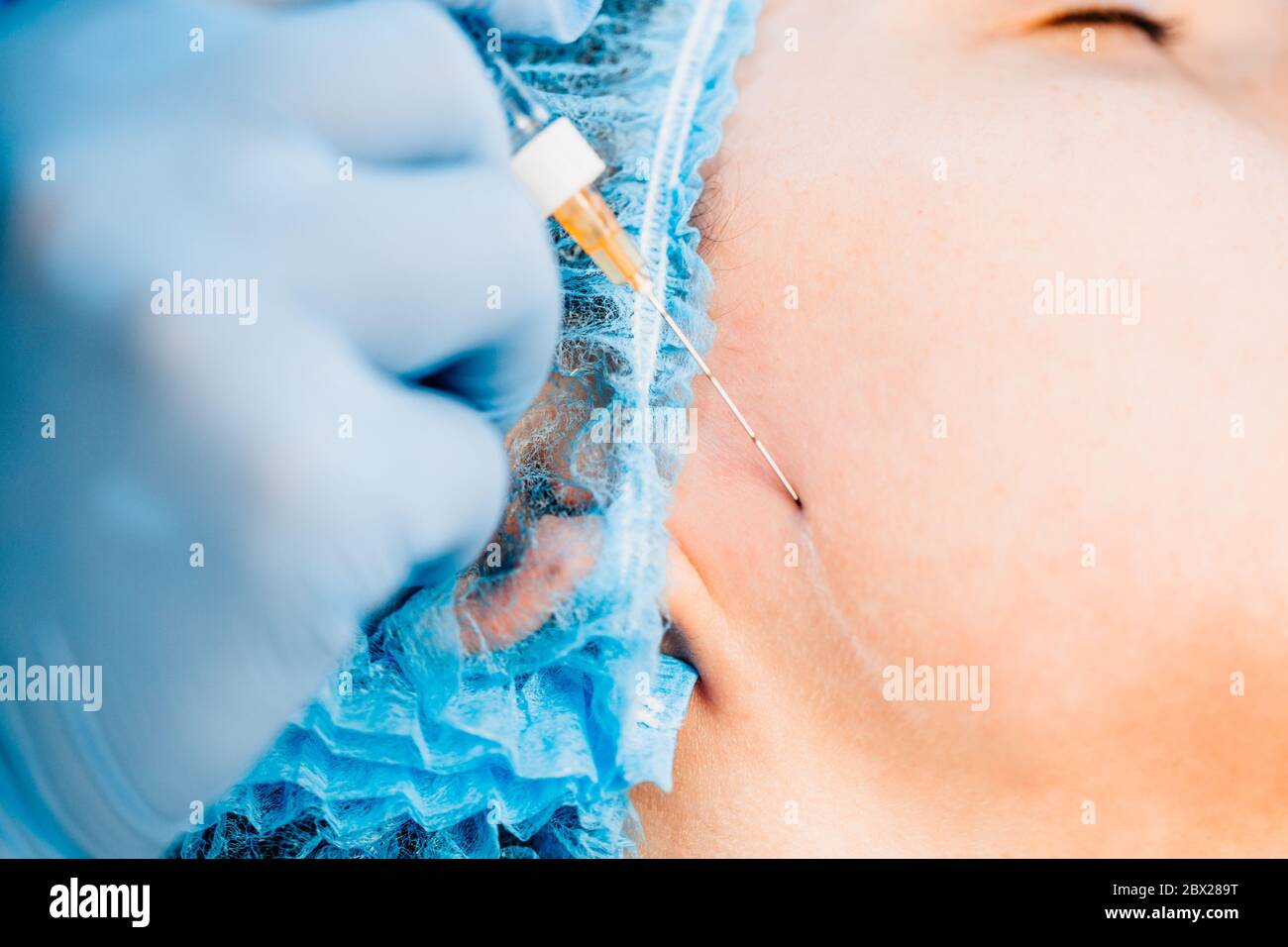 Contour plastics - injection rejuvenation by introducing into the ...